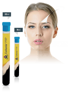 Cellenis PRP – Estar Medical